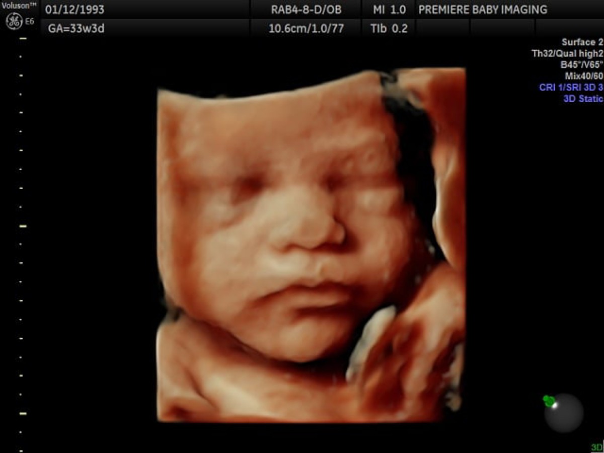 Our Studio | Premiere Baby Imaging